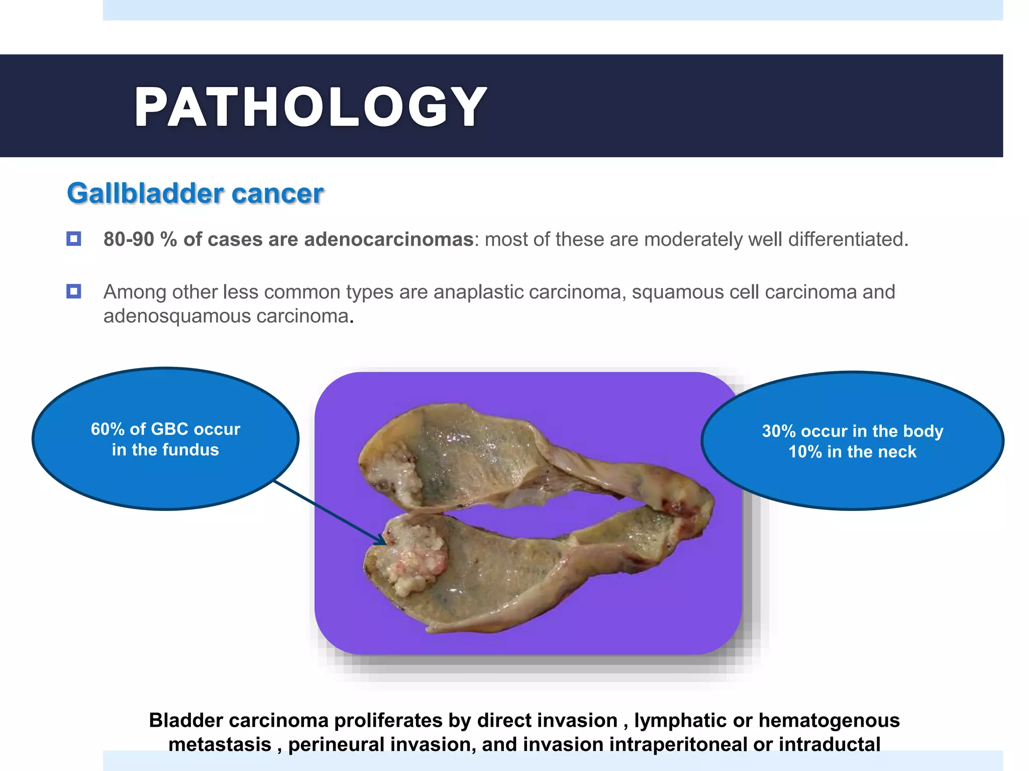 Gallbladder cancer | PPTX