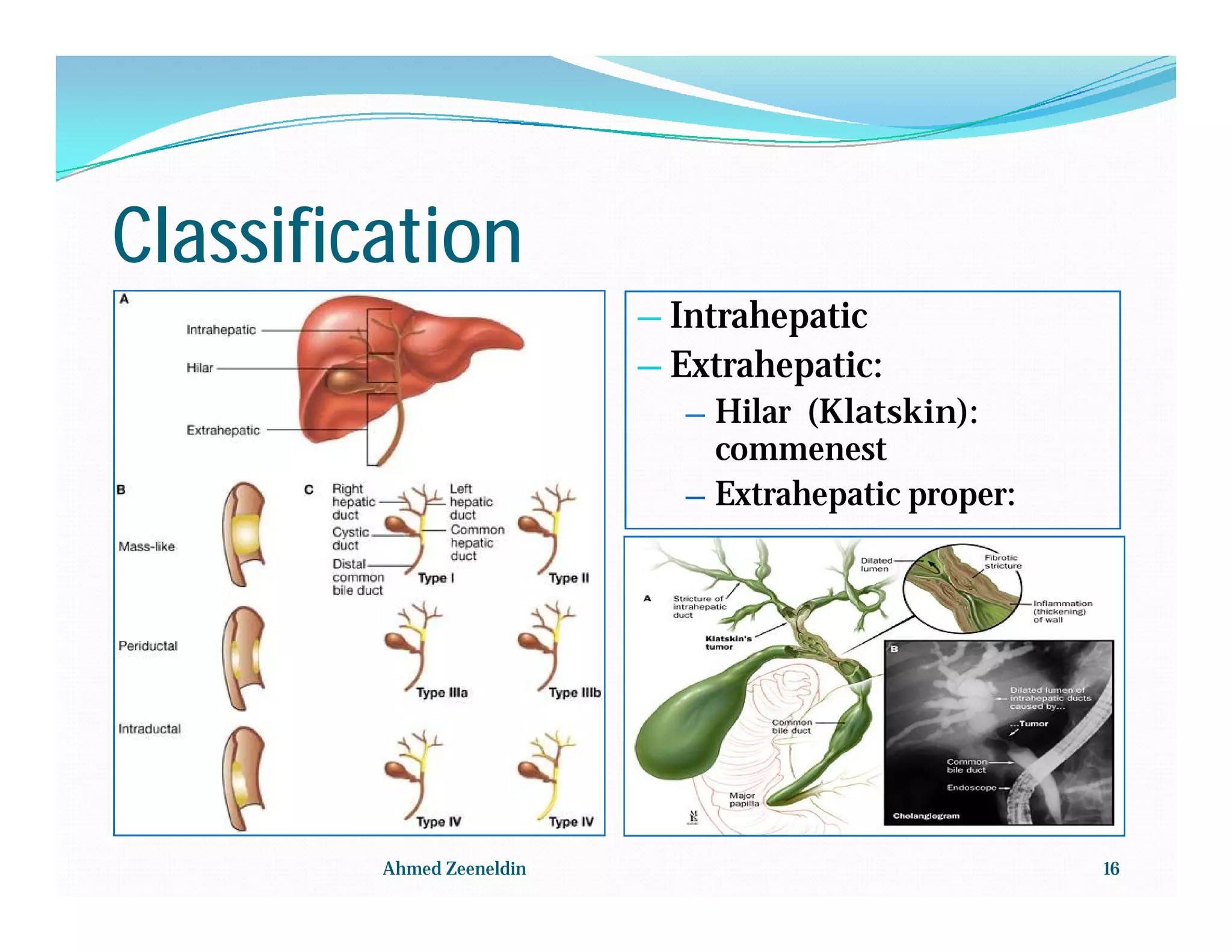 Gall bladder carcinoma | PDF