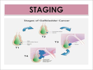 Gall bladder carcinoma.03