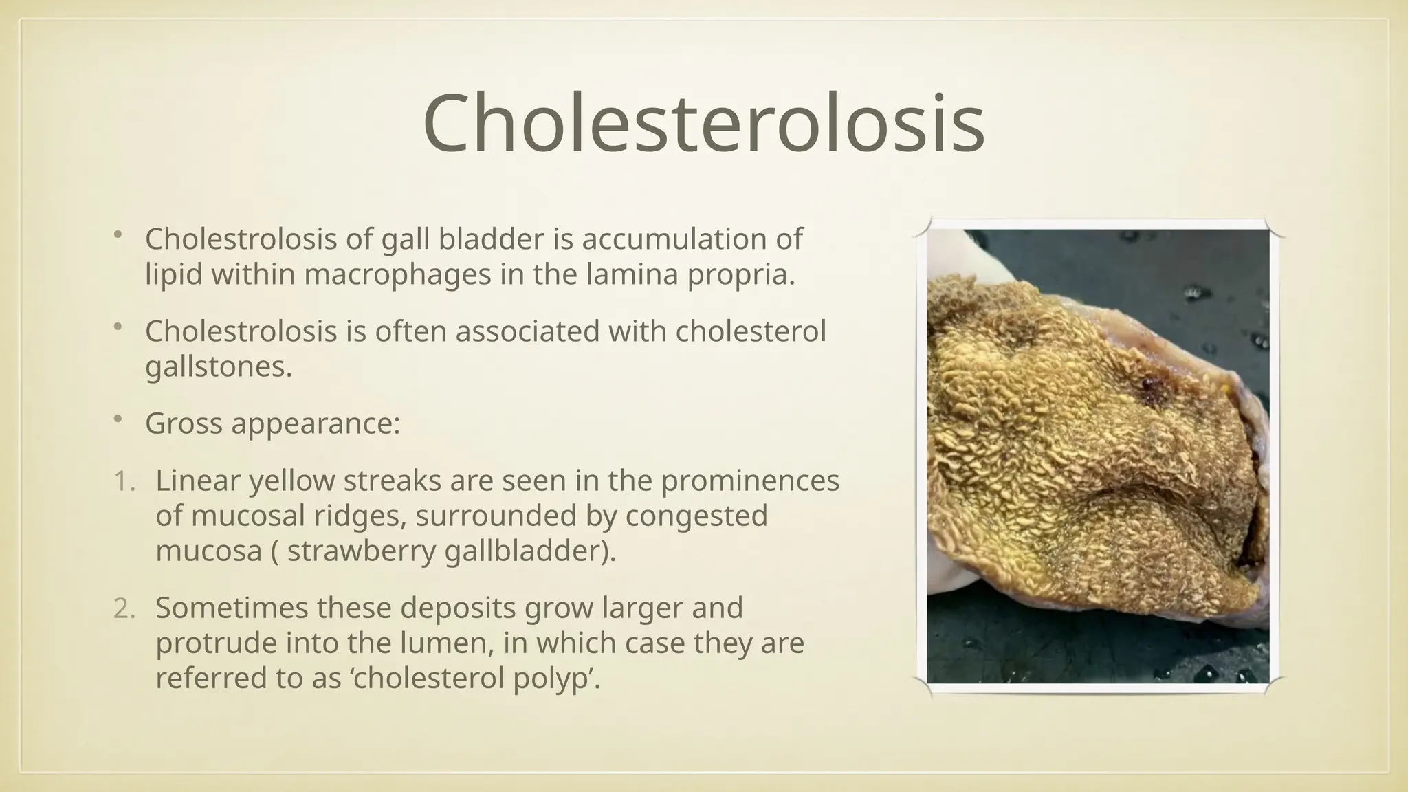 Comprehensive overview on Grossing of Gallbladder | PPTX