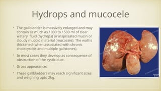 Comprehensive overview on Grossing of Gallbladder | PPTX