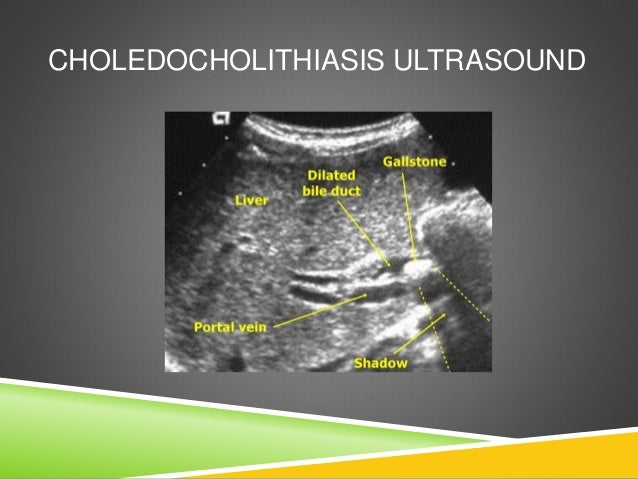 Gallbladder disease galster