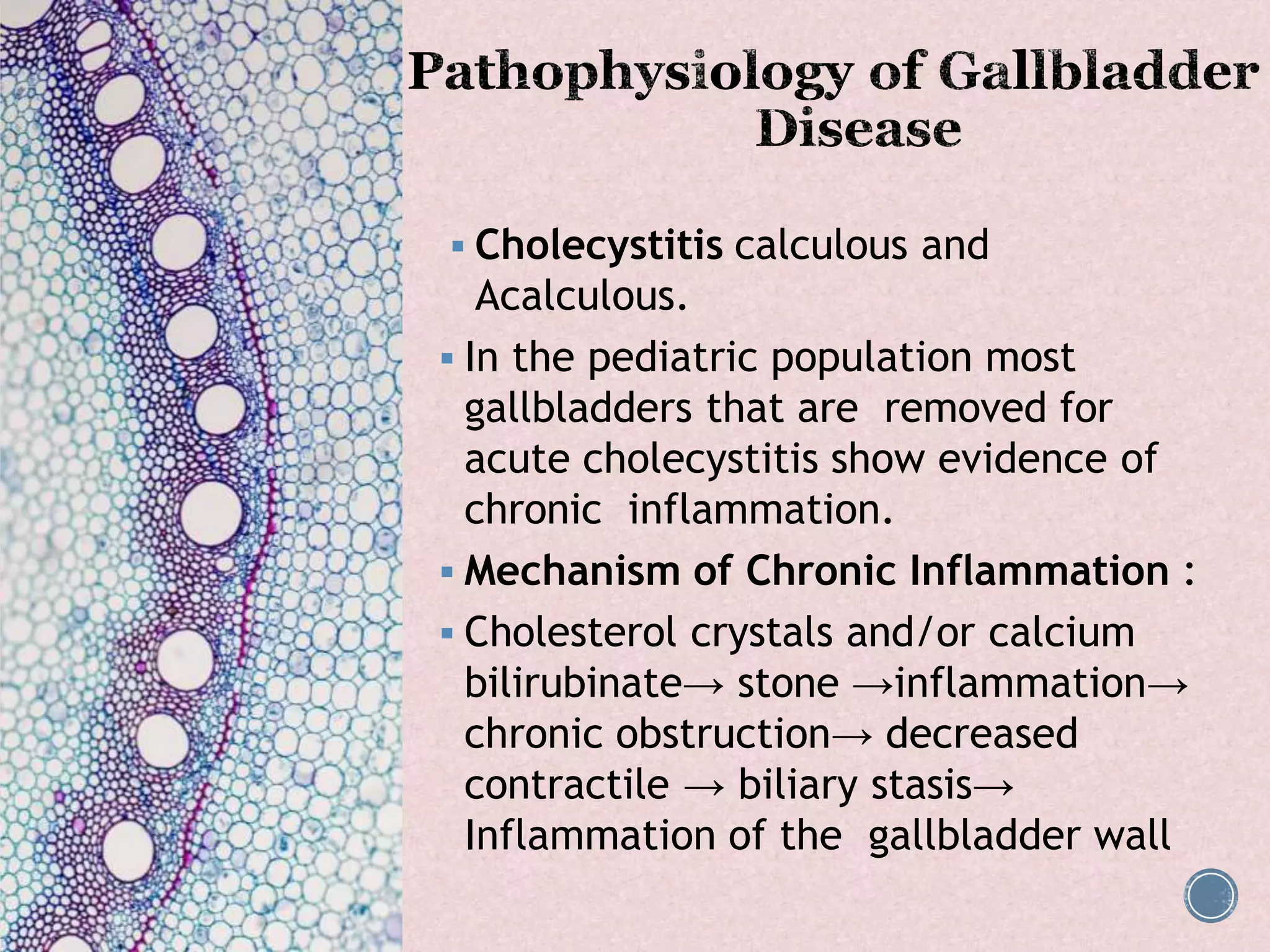 Gallbladder Disease in Children.pptx