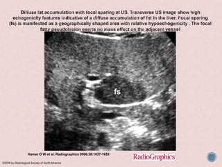 Gallbladder Disease in Children.pptx