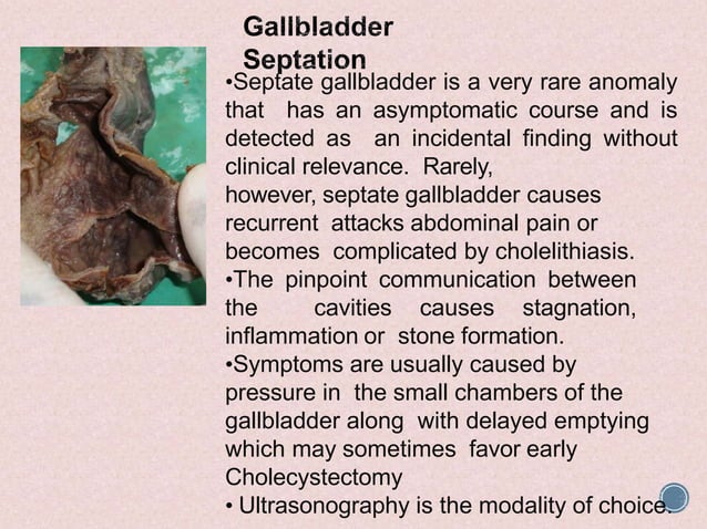 Gallbladder Disease in Children.pptx