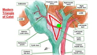 Gallbladder Disease | PPTX