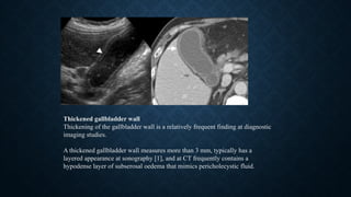 imaging works n gall bladder pathologies | PPTX