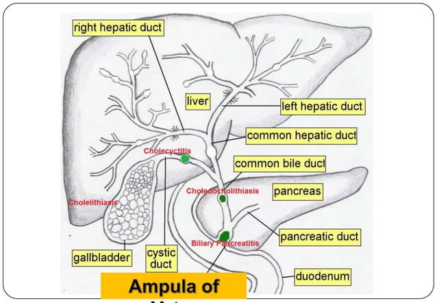Gallbladder, The Big Picture | PPT