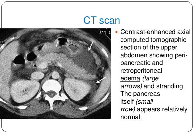 Gallbladder, The Big Picture