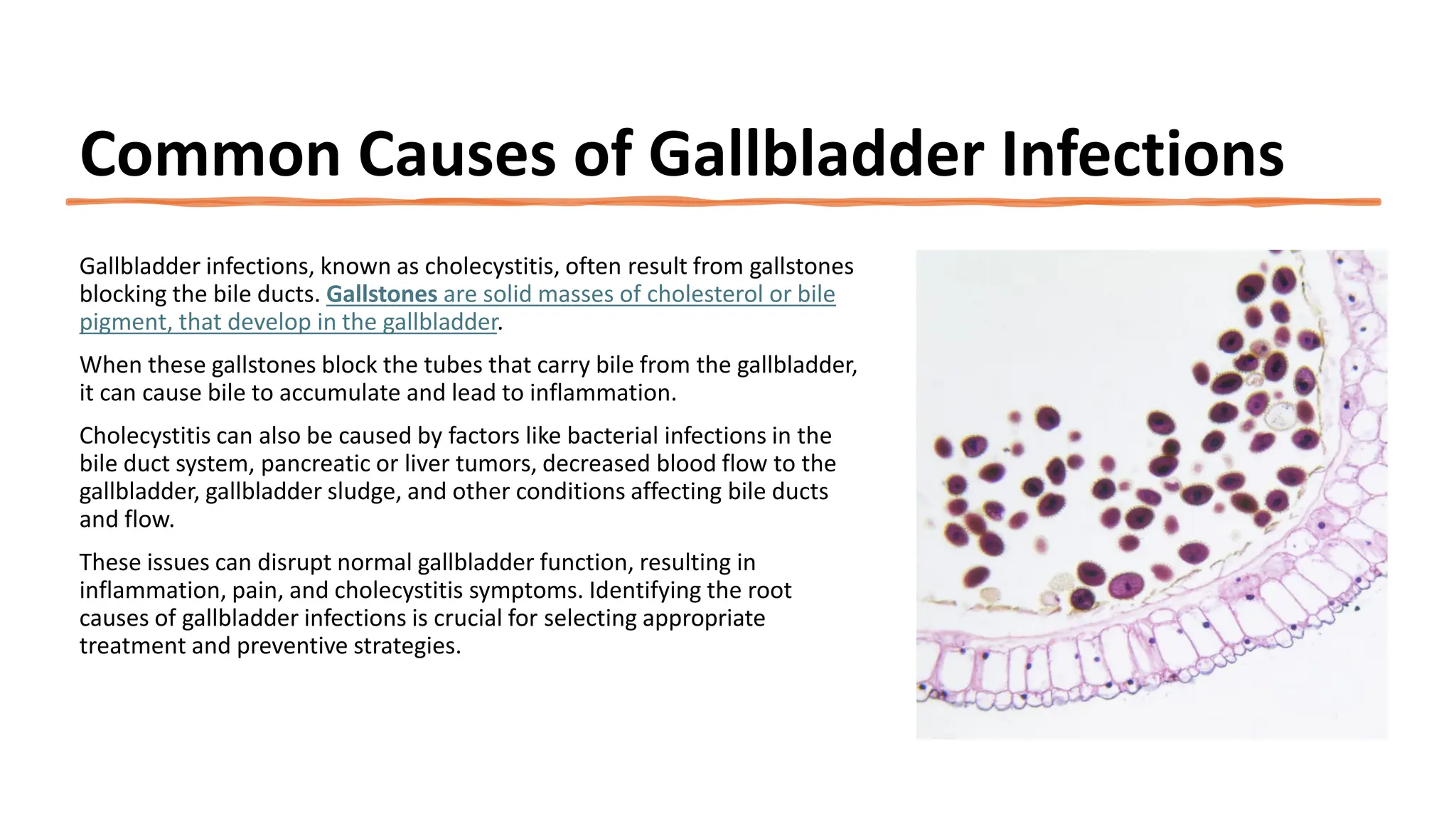 Gallbladder Infection - Exploring Treatment Options.pdf