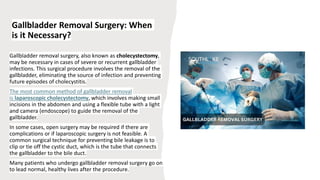 Gallbladder Infection - Exploring Treatment Options.pdf