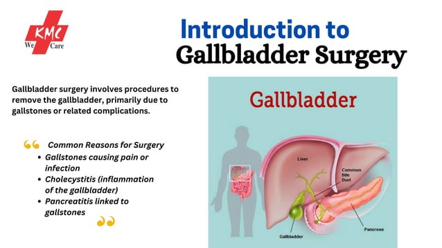 Essential Insights into Gallbladder Surgery | PPT