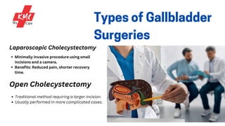 Essential Insights into Gallbladder Surgery | PPT