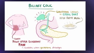 Gall bladder lecture | PPT