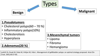 Gallbladder polyp more than 1cm. is cholecystectomy necessary | PPTX
