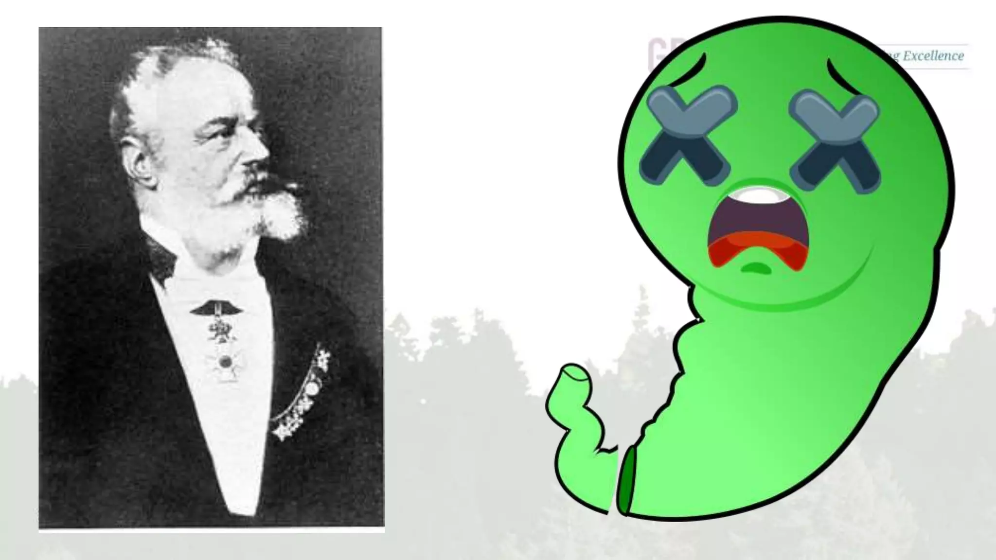 Fun Functional Gallbladder Disorders: Update on Hypo and Hyperkinetic Gallbladder and Sphincter ...