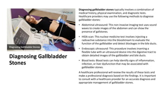 Gallbladder Stones - (Cholelithiasis) Symptoms & Solutions.pdf