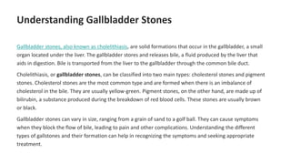 Gallbladder Stones - (Cholelithiasis) Symptoms & Solutions.pdf