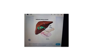 Gall bladder_storage_inducers of gall secretions.pptx
