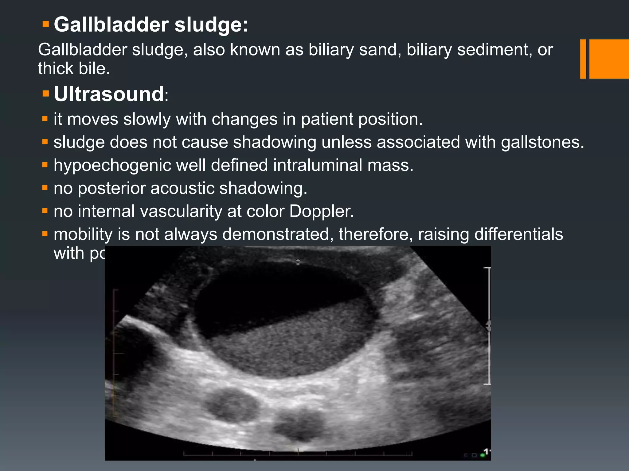 Gallbladder ultrasound (basic) | PPTX