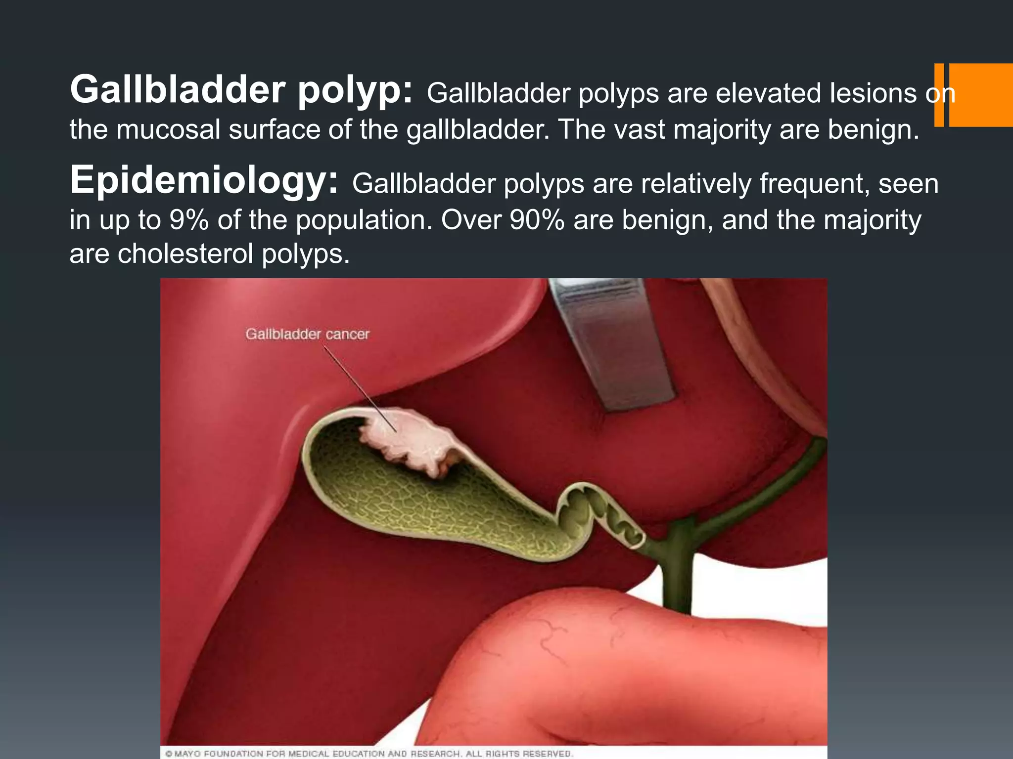 Gallbladder ultrasound (basic) | PPTX
