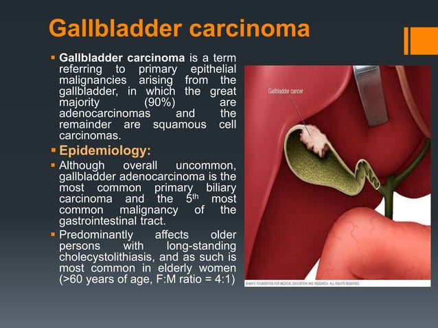 Gallbladder ultrasound (basic) | PPTX