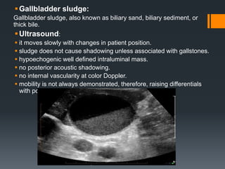 Gallbladder ultrasound (basic) | PPTX