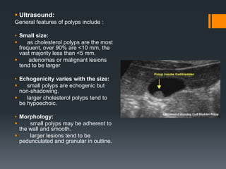 Gallbladder ultrasound (basic) | PPTX