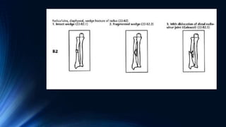 Galleazi fracture dislocation | PPTX