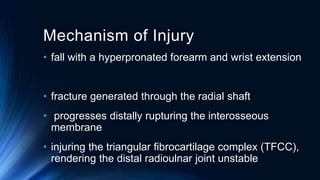 Galleazi fracture dislocation | PPTX