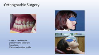 Interesting Cases by Dr. Michaelides | PPT