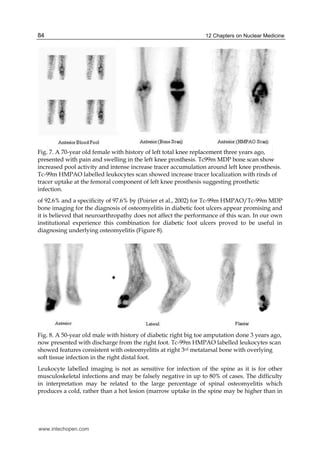 Diagnosis And Corresponding Gallium Scan