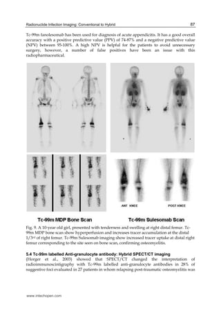 Diagnosis And Corresponding Gallium Scan