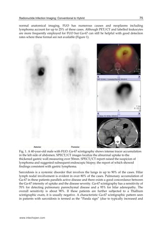 Diagnosis And Corresponding Gallium Scan