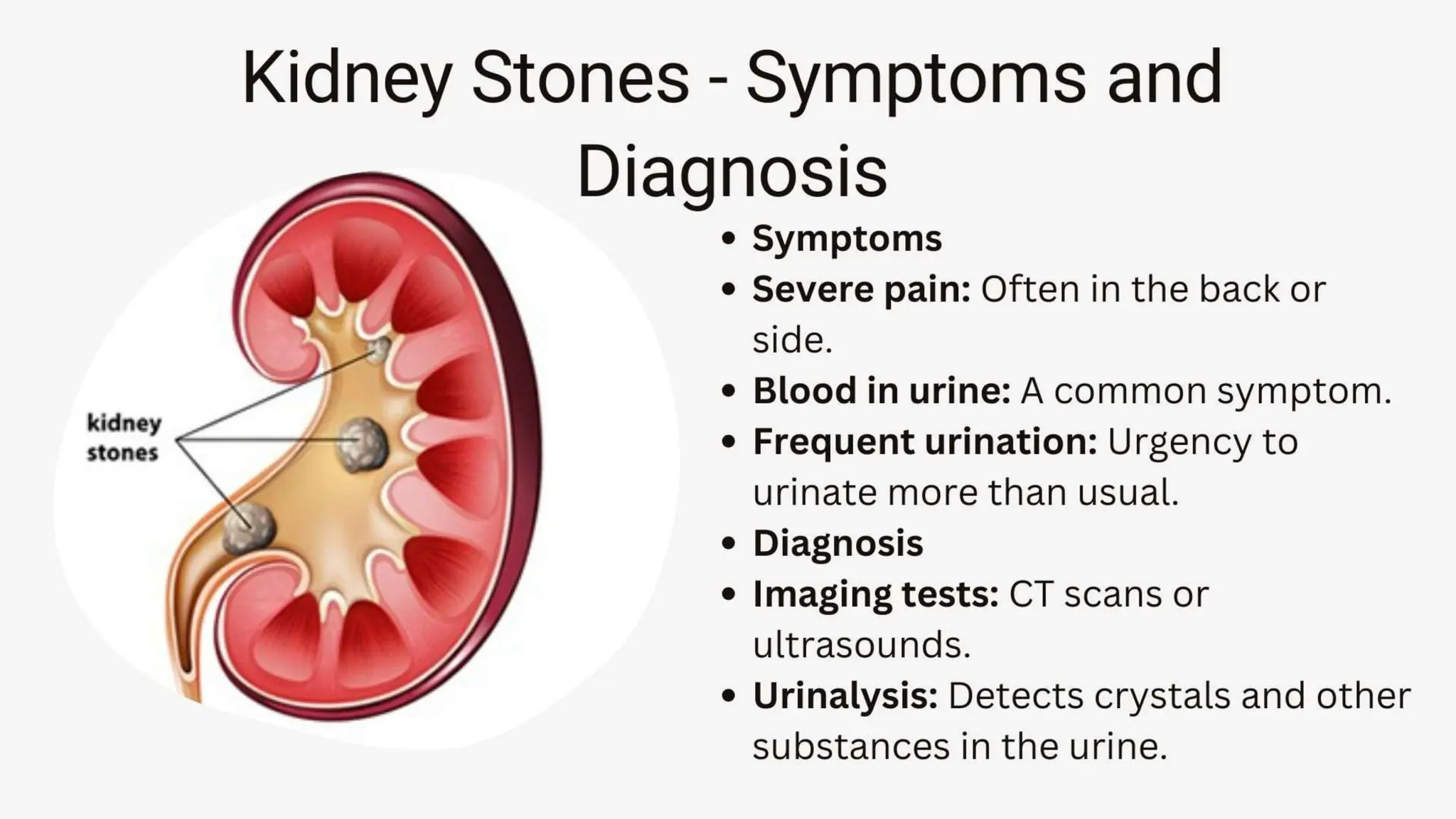 Gallstone and Kidney Stone - Know The Difference.pptx