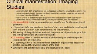 Gall stone disease | PPTX