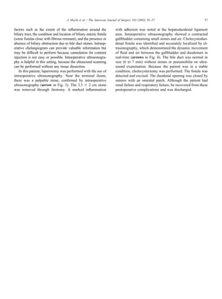 Gallstone ileus with cholecystoduodenal ﬁstula | PDF