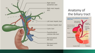 Gall stone management Copy.pptx