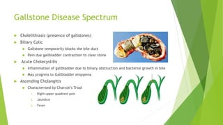 Gallstone Disease and management teaching | PPT