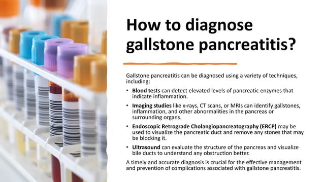 Gallstone Pancreatitis – Symptoms and Treatment.pdf