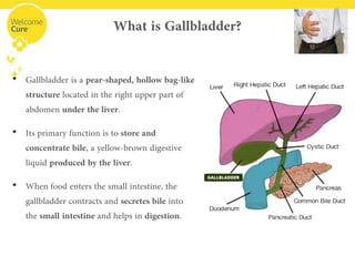 Gallstones- The ailment and its alleviation with Homeopathy. | PDF