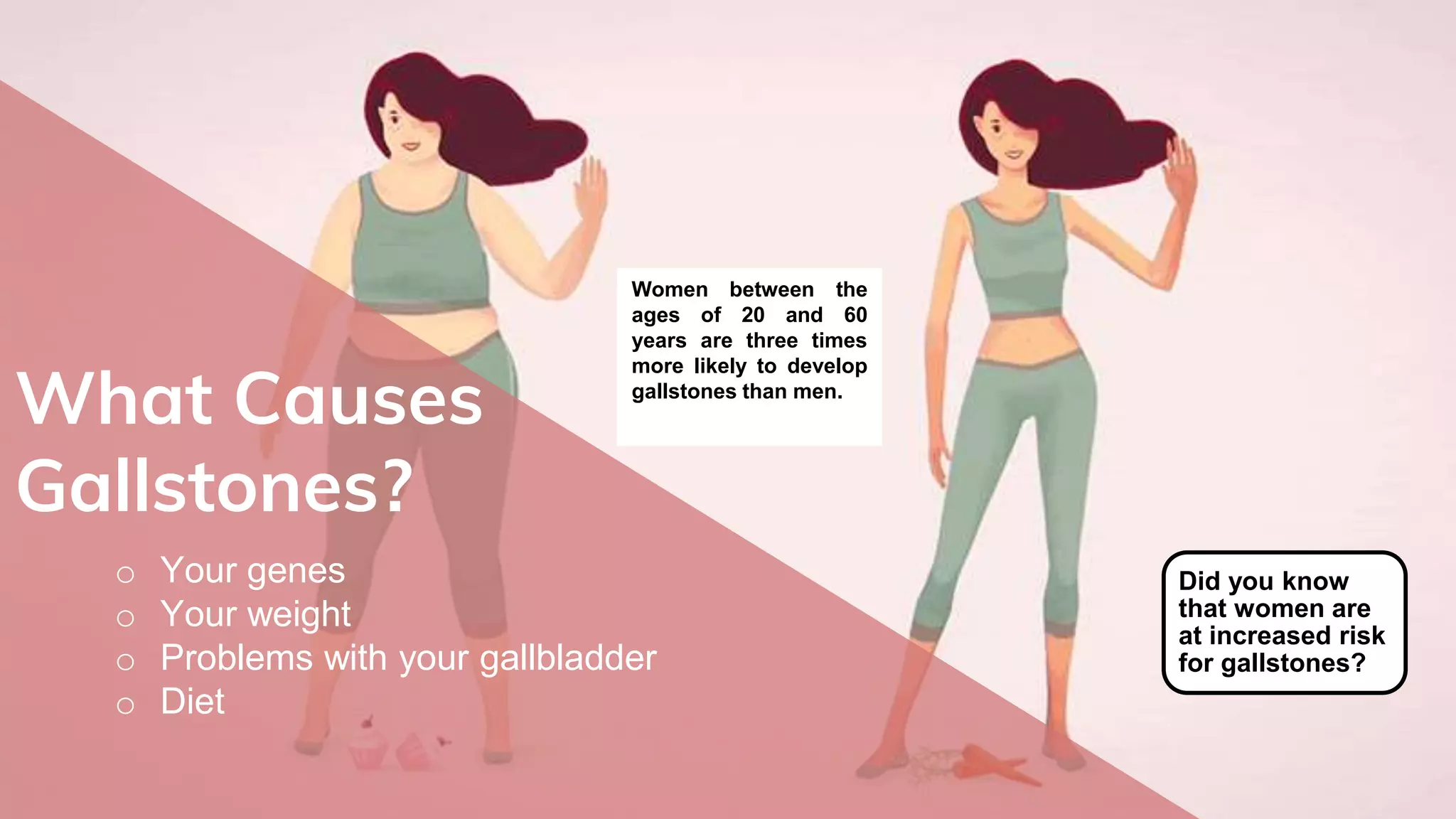 Gallstones | PPTX