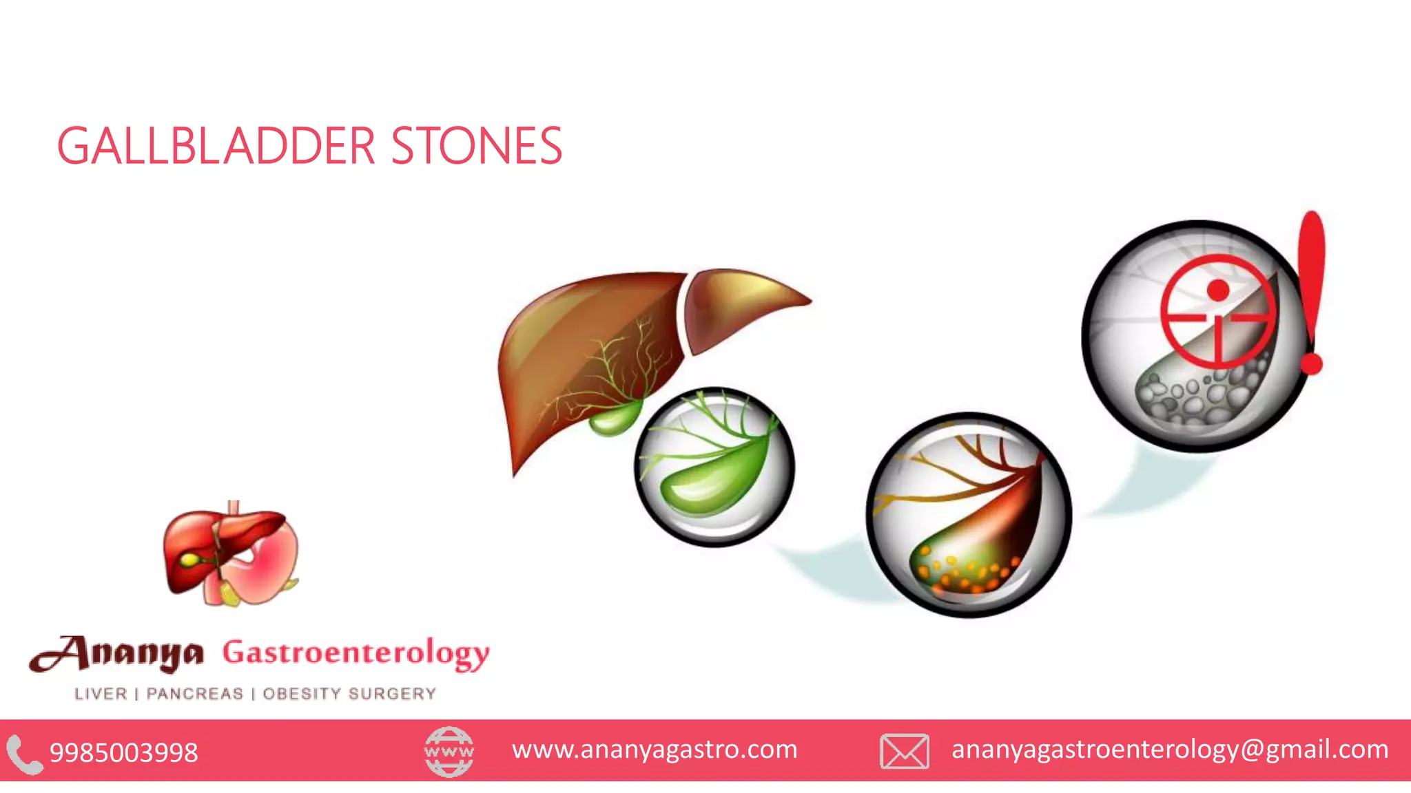 Gallbladder Stone / Gallstones causes, symptoms and treatment by Ananya ...