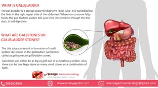 Gallbladder Stone / Gallstones causes, symptoms and treatment by Ananya ...