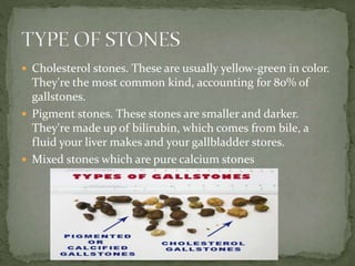 Gall stones | PPT