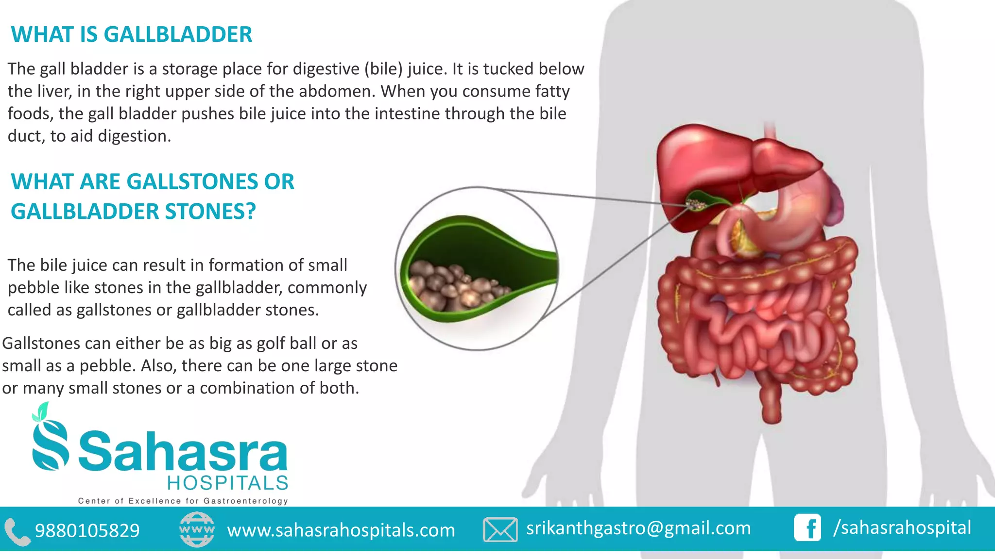 GALLBLADDER STONES SYMPTOMS, CAUSES AND TREATMENT | PPT