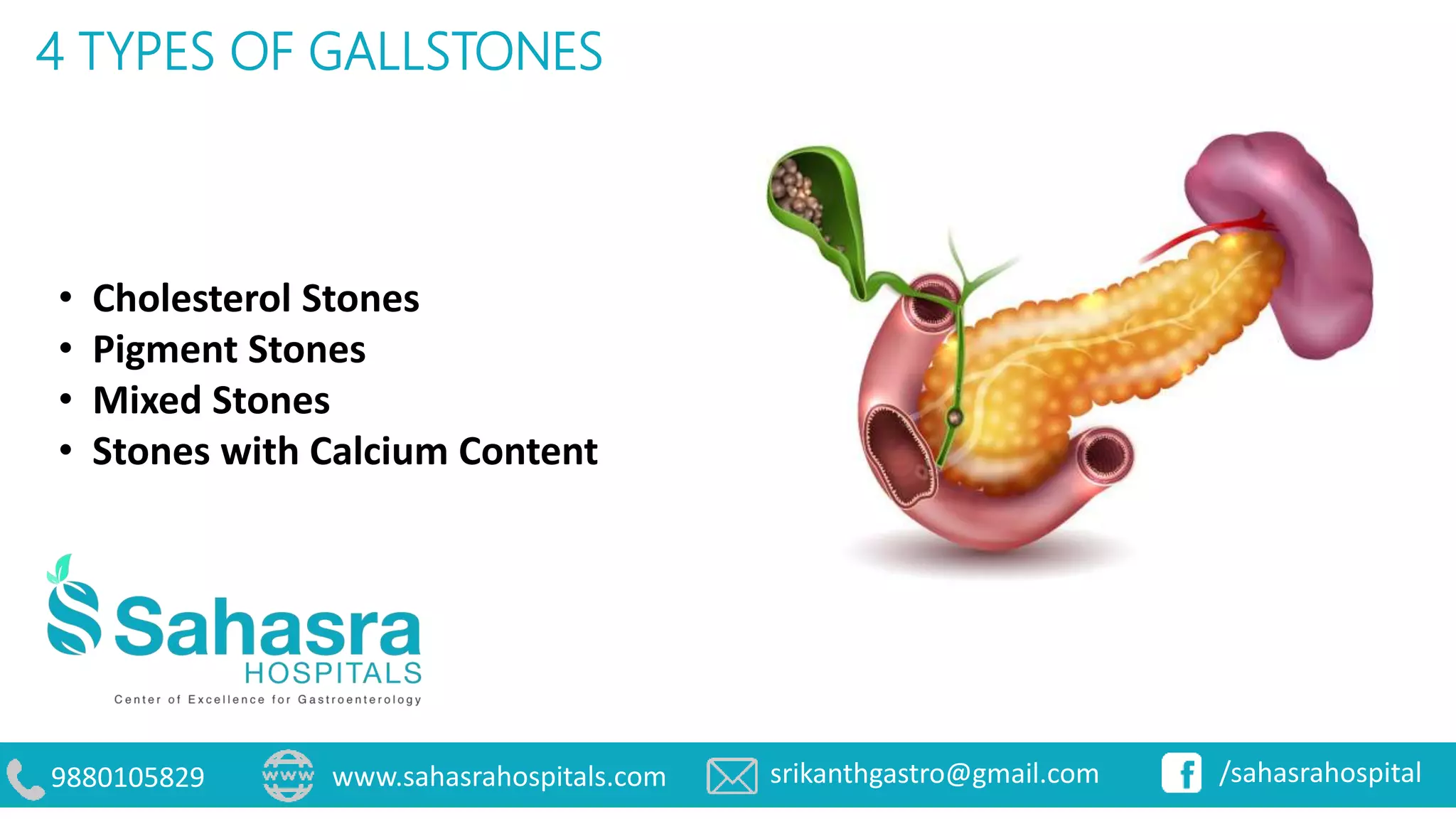 GALLBLADDER STONES SYMPTOMS, CAUSES AND TREATMENT | PPT