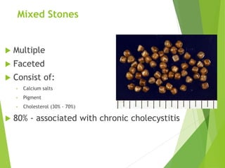 Gall stones disease | PPT