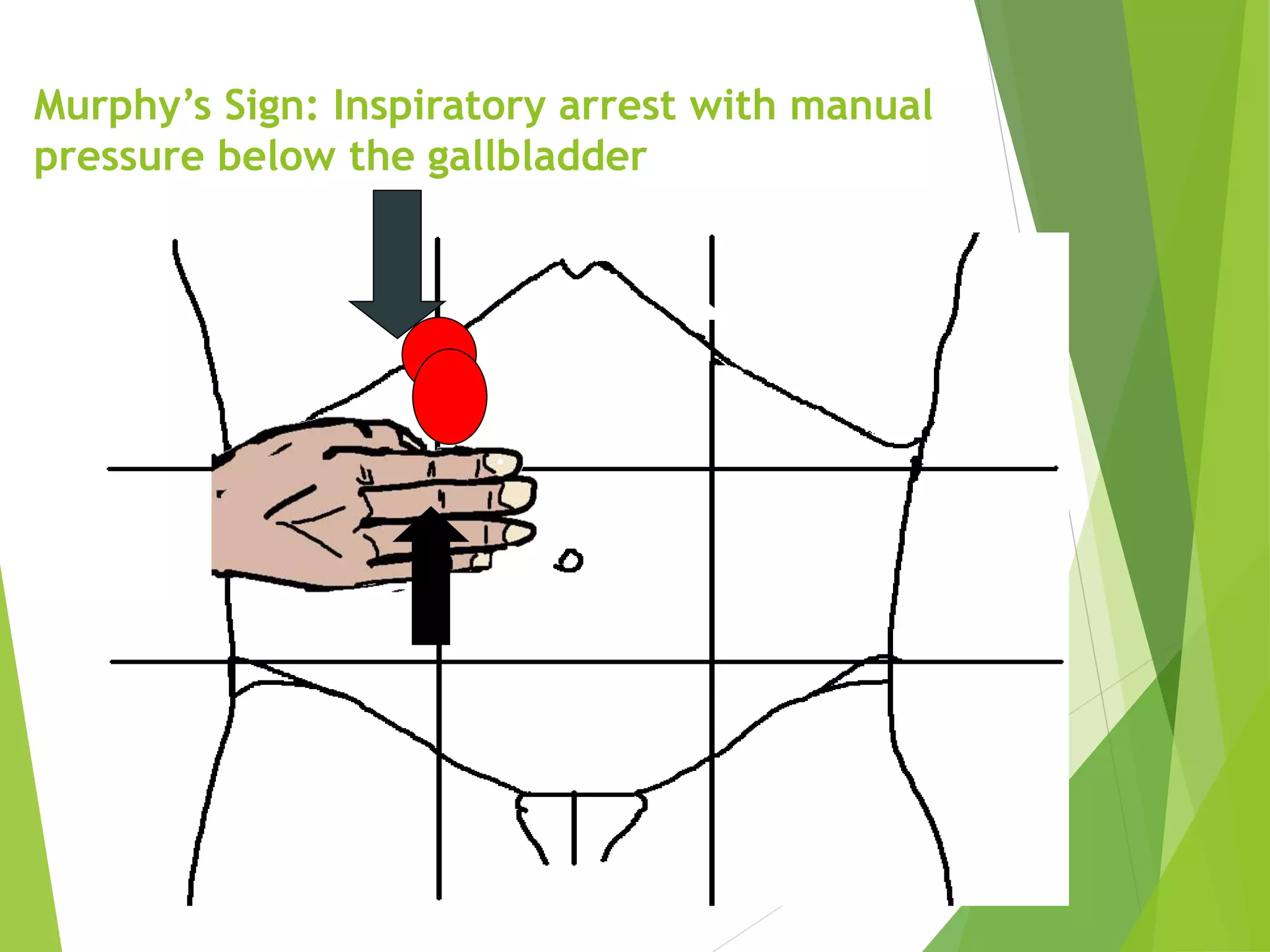 Gall stones disease | PPT