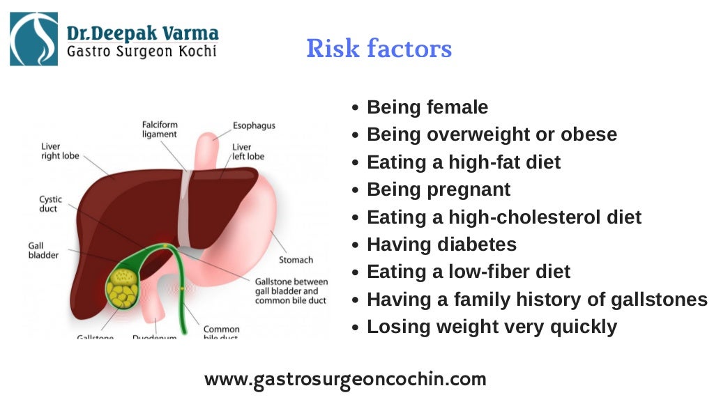 Bile Duct Stone Removal in Kochi | Laparoscopic Surgeon in Kerala
